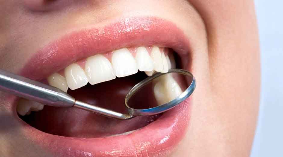 Why Is Ongoing Dental Care Important Even If Your Teeth Feel Fine ...